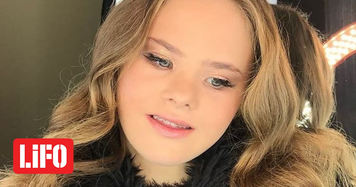 Αυτή η 14χρονη με Σύνδρομο Down έχει ήδη συμβόλαιο με πέντε πρακτορεία ...