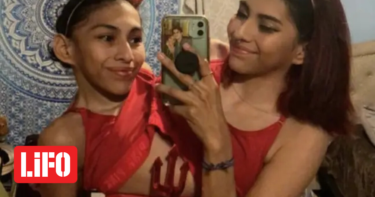 Δύο σιαμαίες περιγράφουν τη ζωή τους: «Εγώ είμαι ασέξουαλ, αλλά η αδερφή μου έχει φίλο» | LiFO